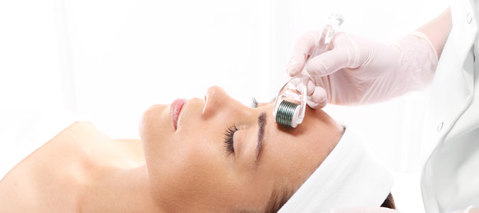 Microagulhamento - Regina Estética e Cabelo - clínica de estética